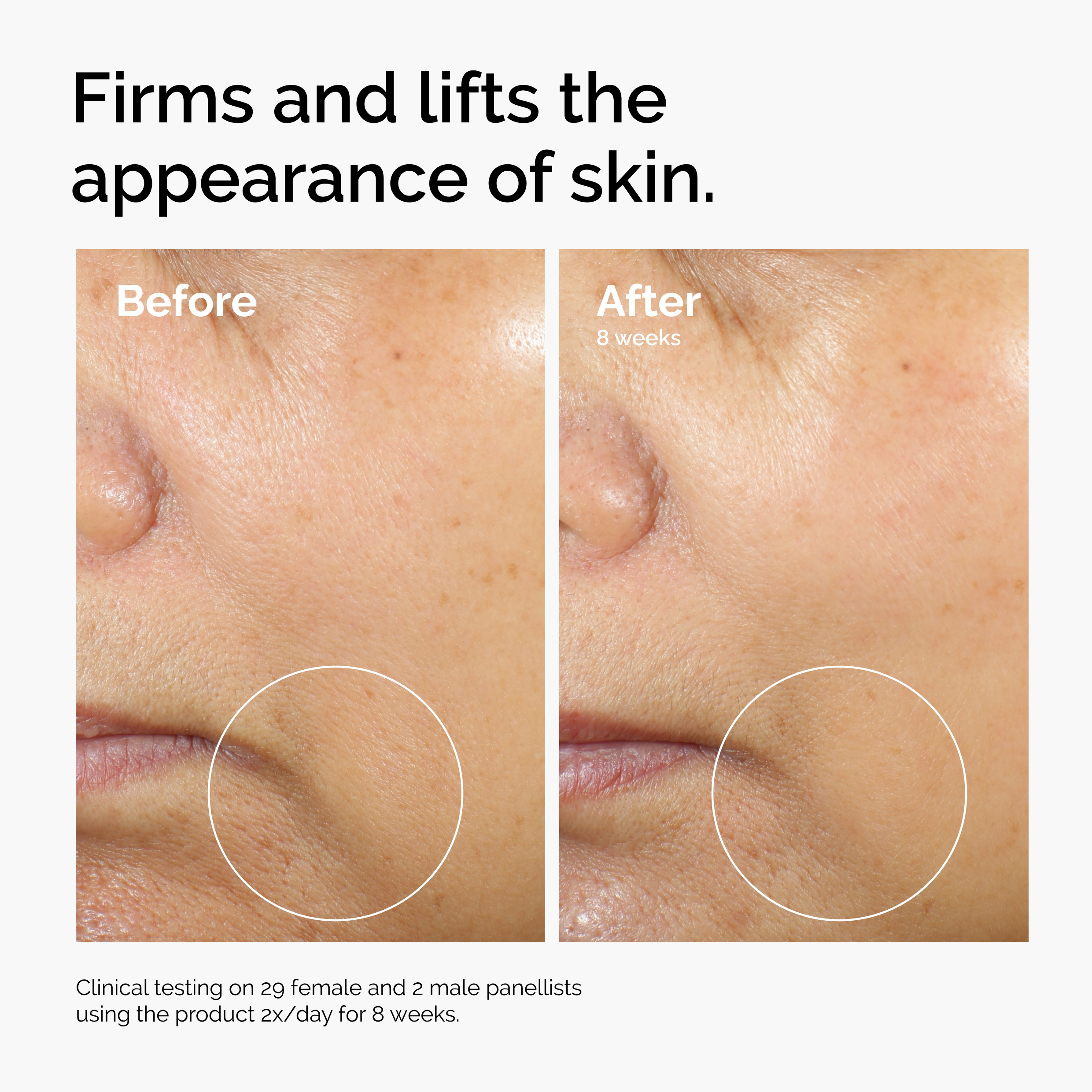The Ordinary Caffeine 3% + Escin 1% Face Serum 1 fl. oz.(30ml) | OLIVE ...